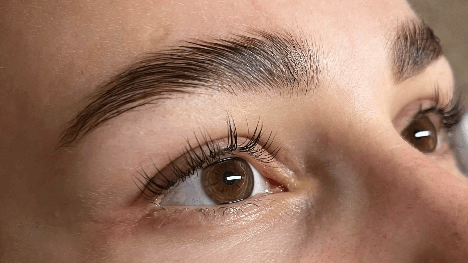 Brow Lifting München » Seelenwellness